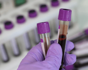 Exame Cloretos, Cloro, Ou Cloremia, Coleta Do Sangue Ou Urina, Jejum E ...